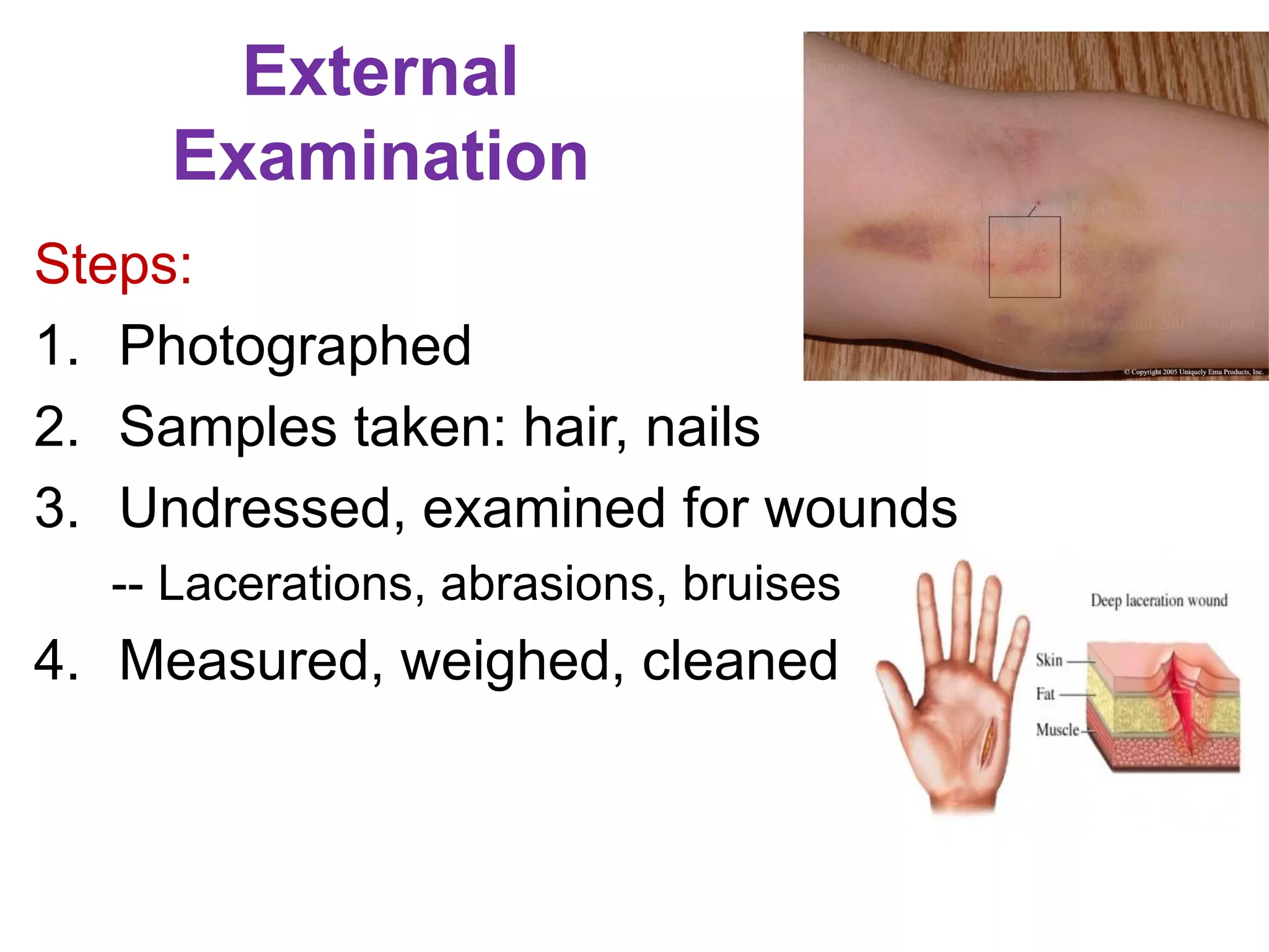 Autopsy, embalming, care of dead body | PDF