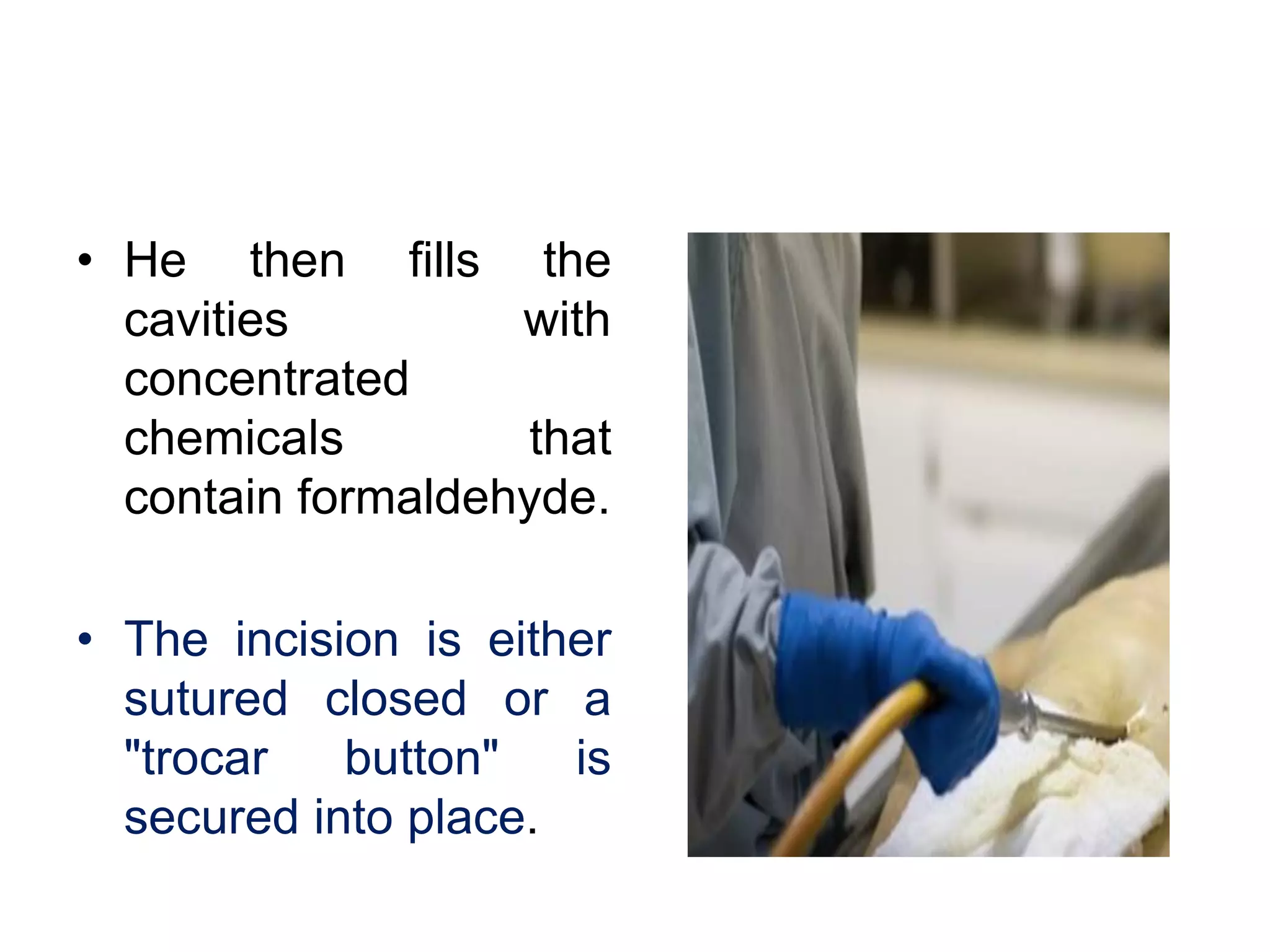 Autopsy, embalming, care of dead body | PDF