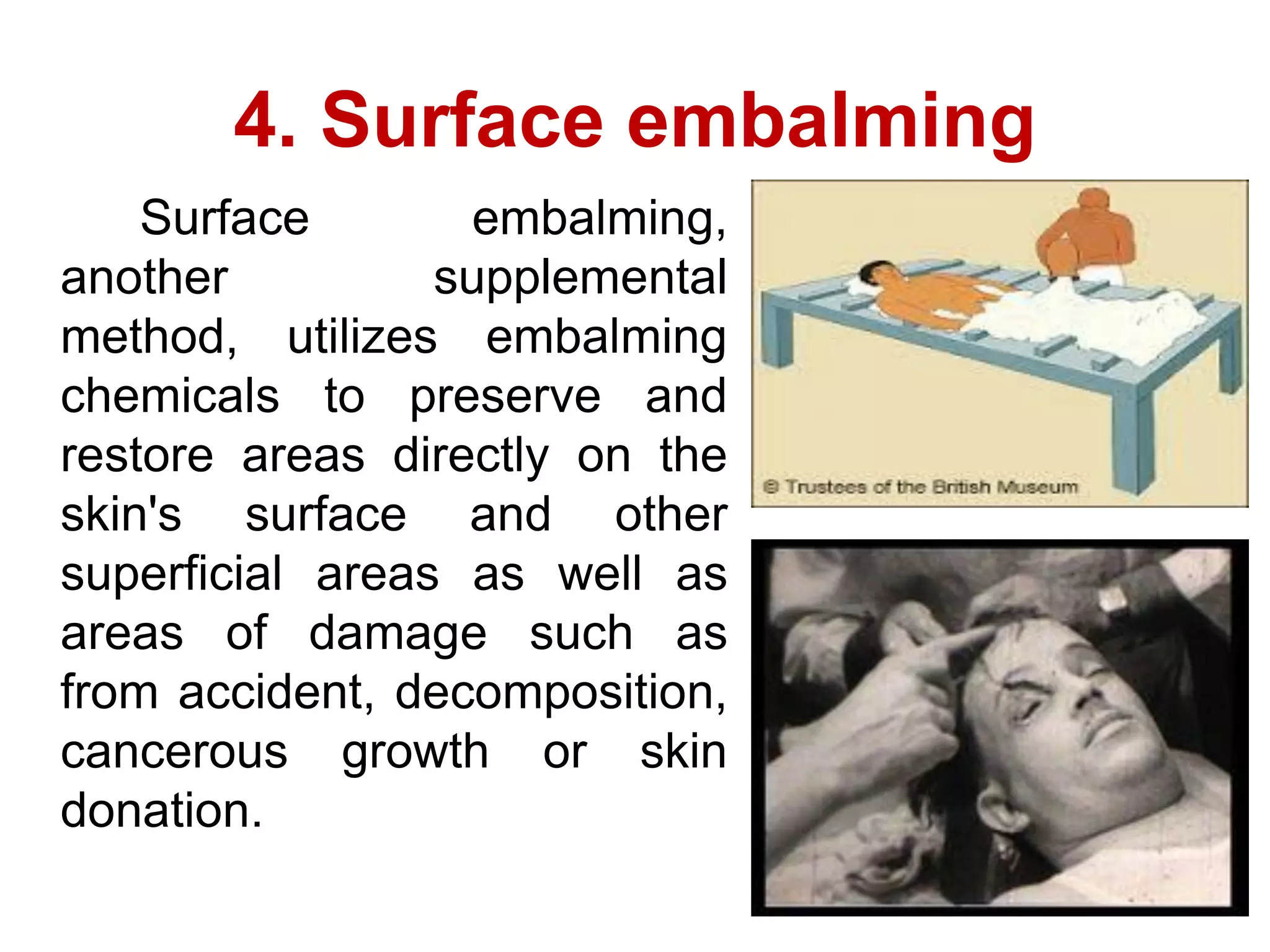 Autopsy, embalming, care of dead body | PDF