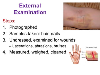 Autopsy, embalming, care of dead body | PDF