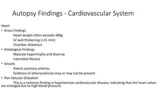 Autopsy Findings in Hypertensive Heart Disease.pptx