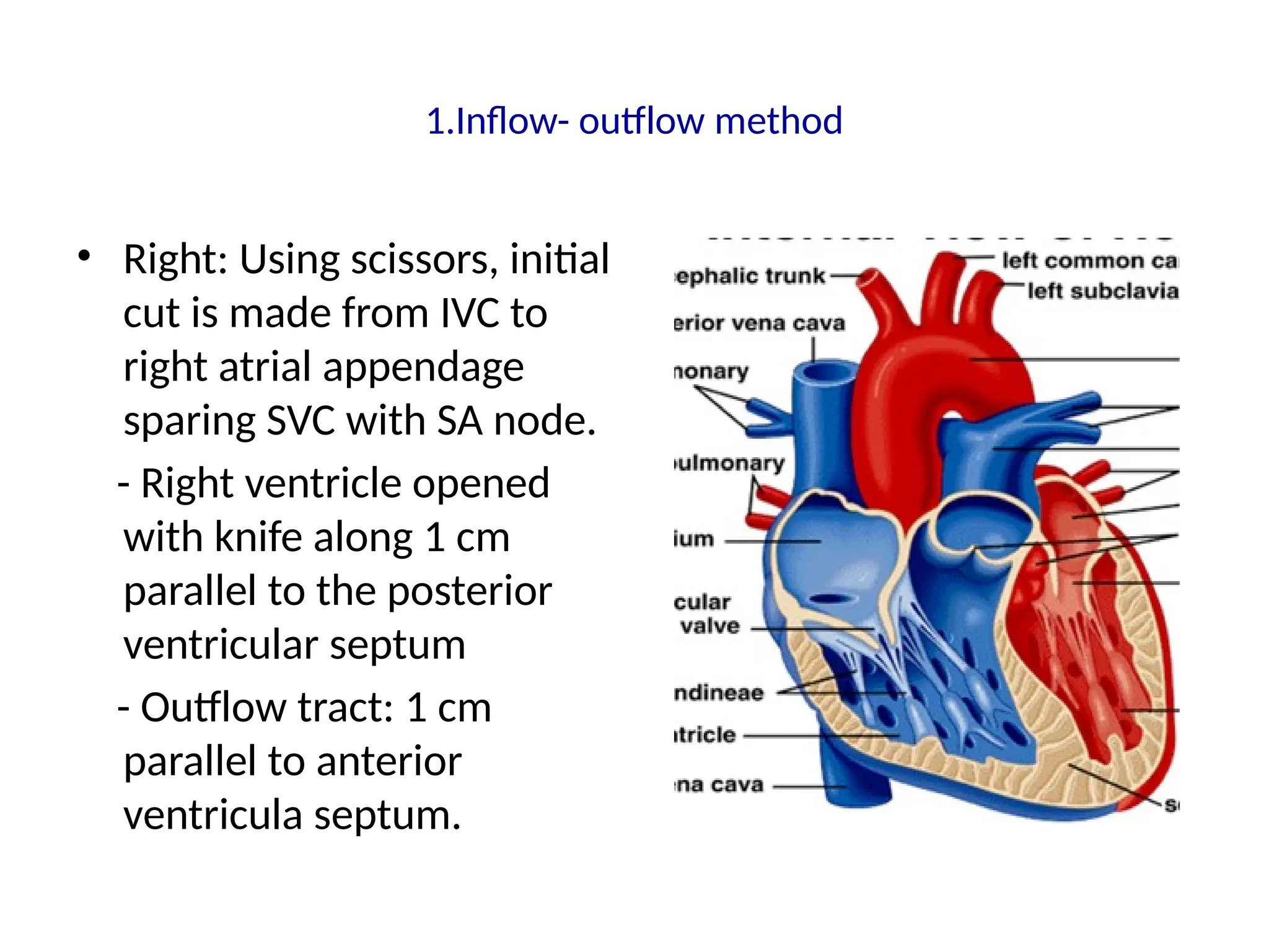 autopsy heart under forensic and investigation.pptx