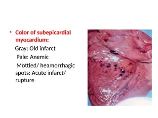 autopsy heart under forensic and investigation.pptx