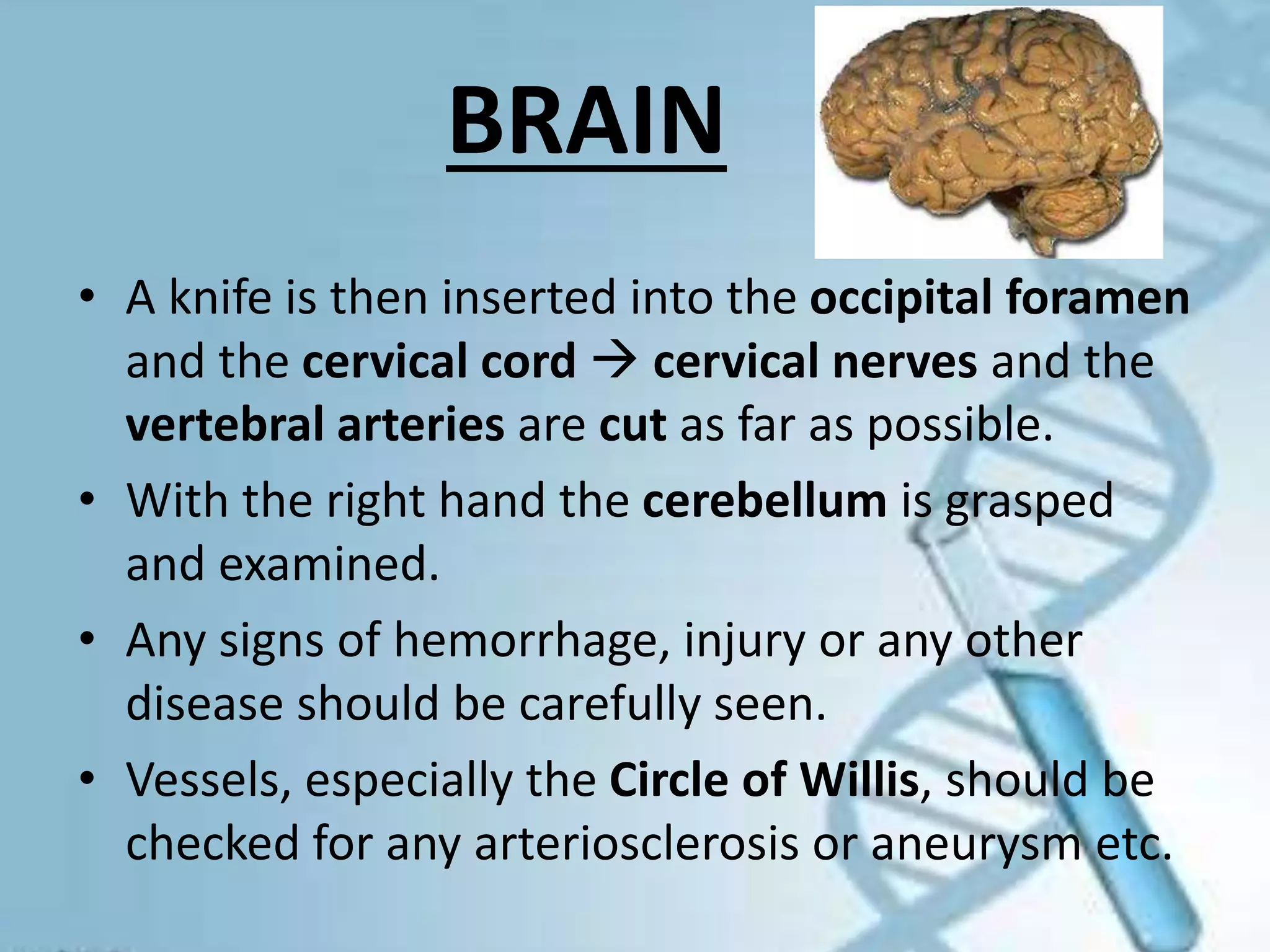 autopsyinternalexamination-140427110739-phpapp02 - Copy.pptx