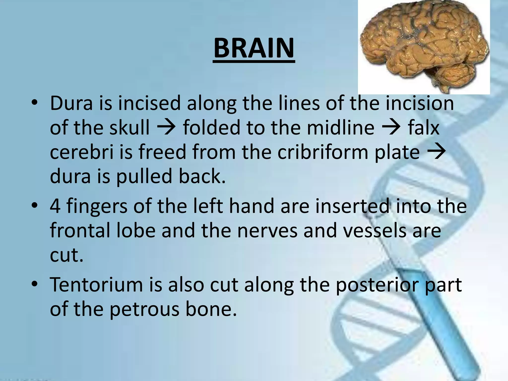 Autopsy internal examination, Forensic Medicine, Post-mortem ...