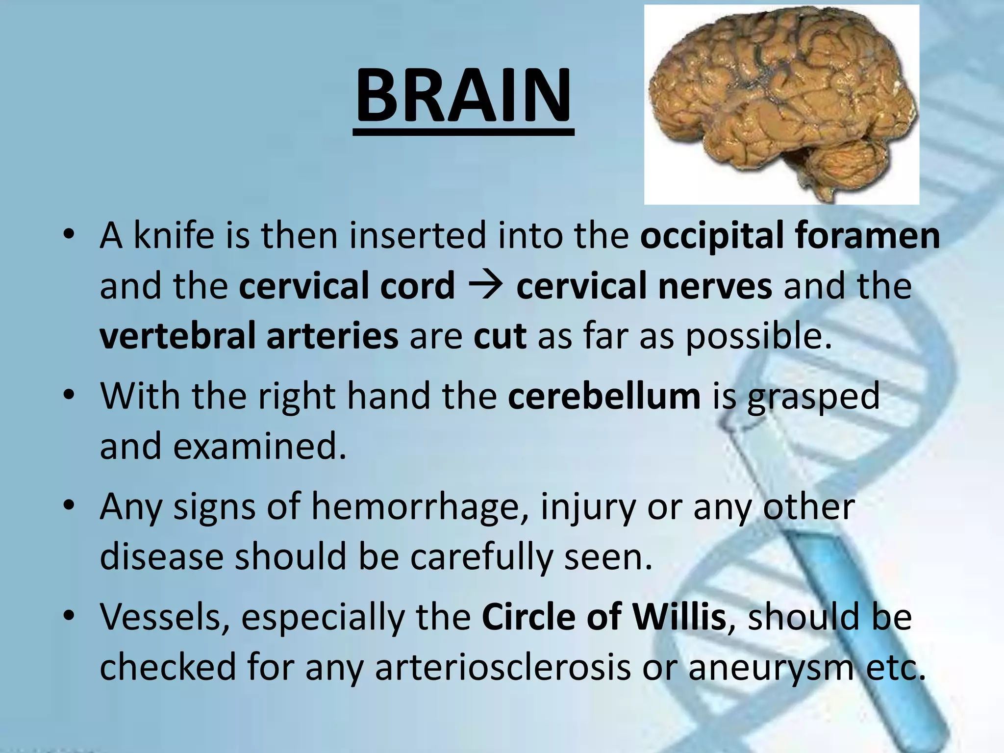 Autopsy internal examination, Forensic Medicine, Post-mortem ...