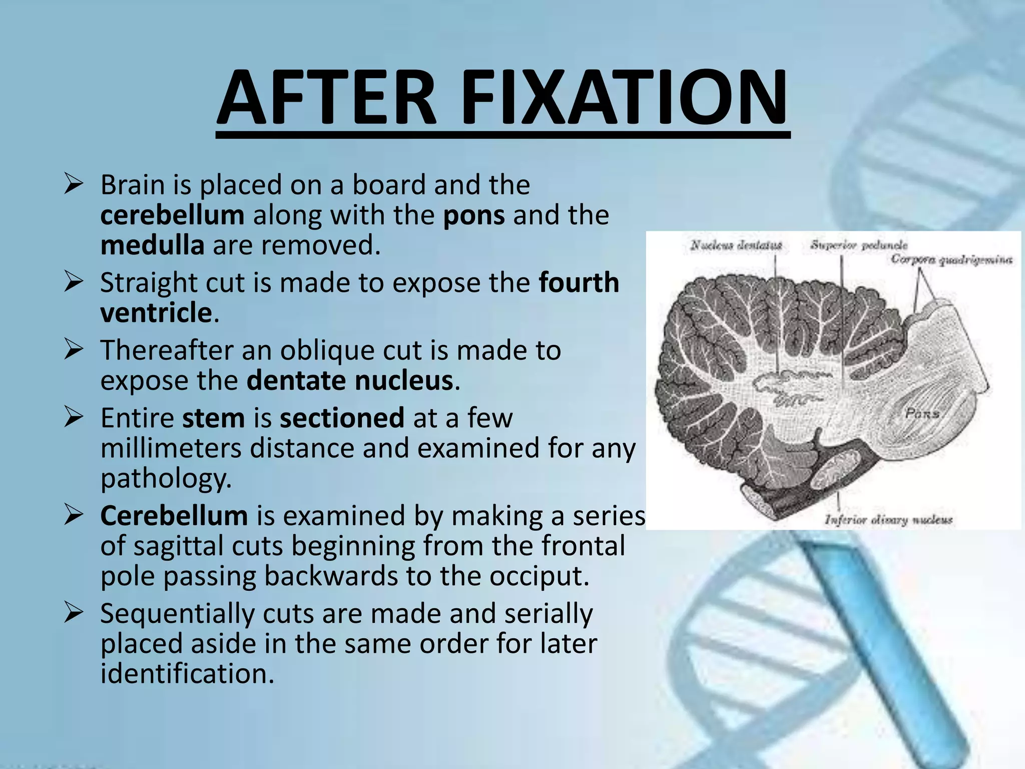 Autopsy internal examination, Forensic Medicine, Post-mortem ...