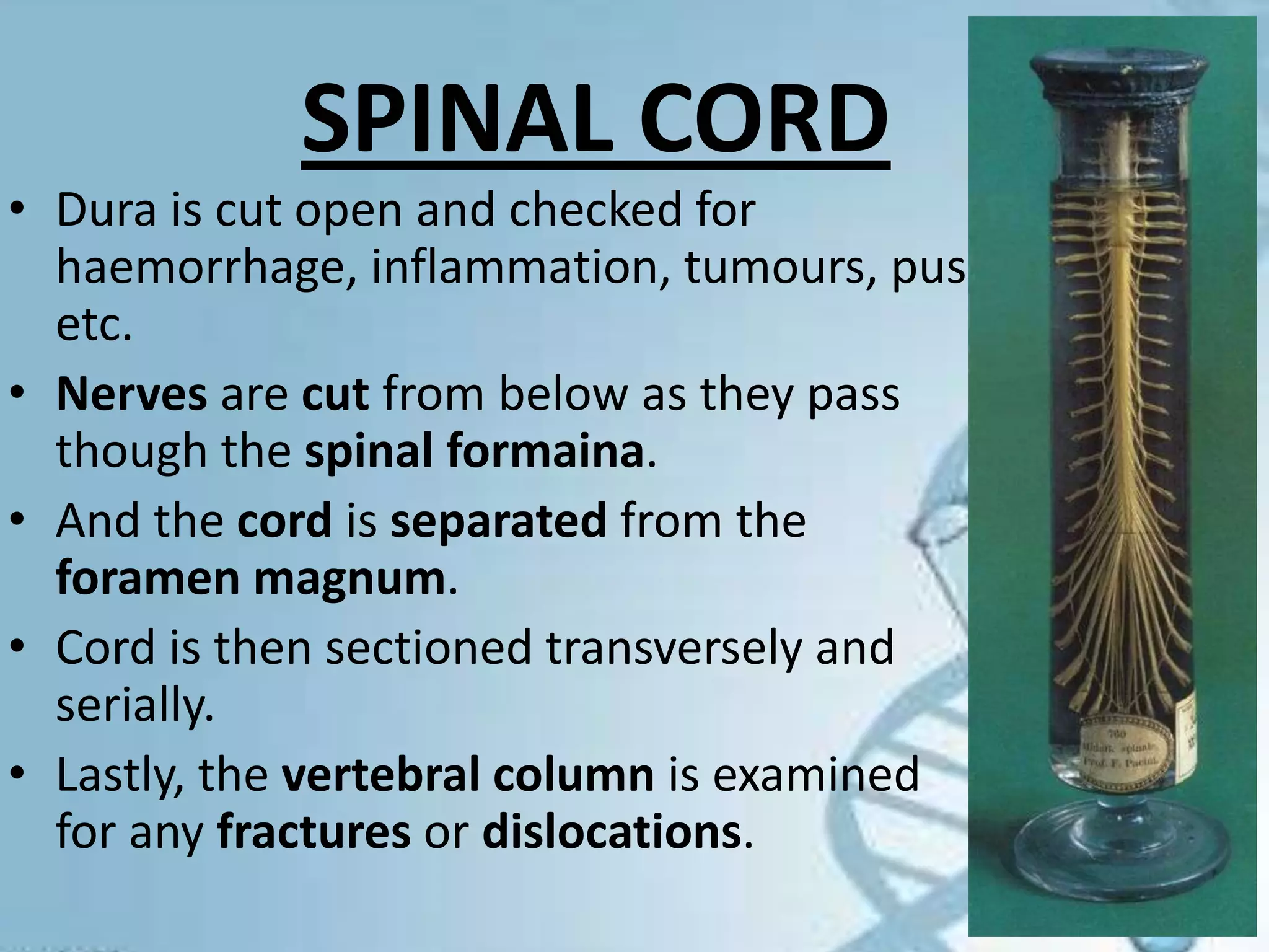 Autopsy internal examination, Forensic Medicine, Post-mortem ...