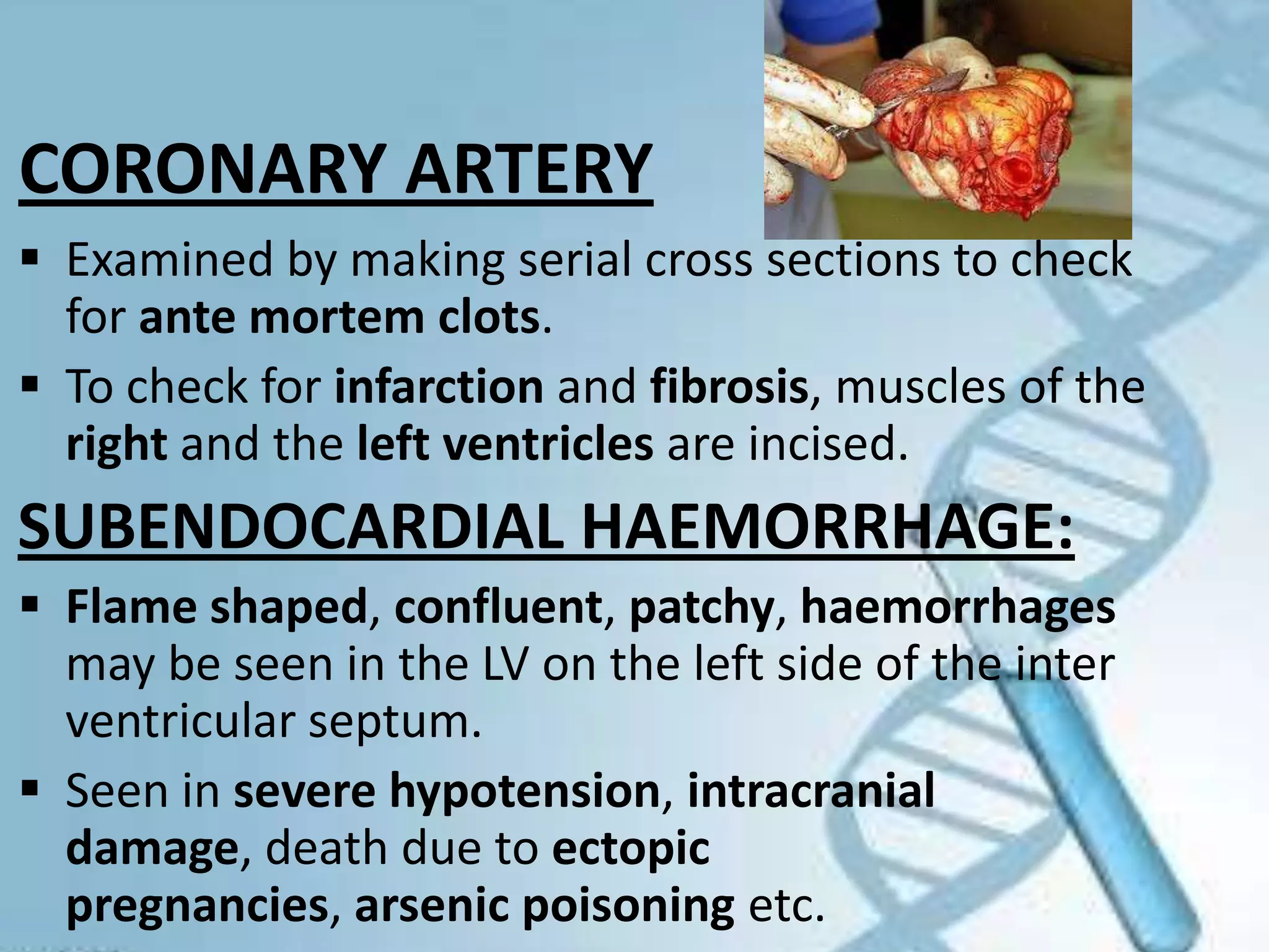 Autopsy internal examination, Forensic Medicine, Post-mortem ...