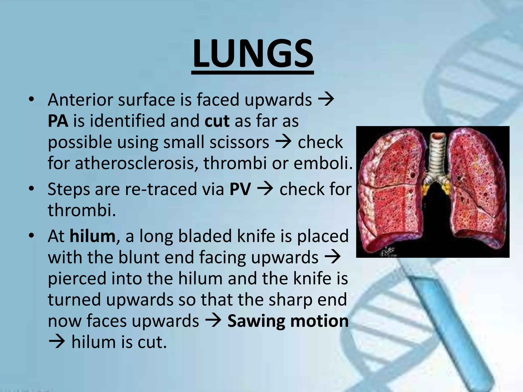 Autopsy internal examination, Forensic Medicine, Post-mortem ...
