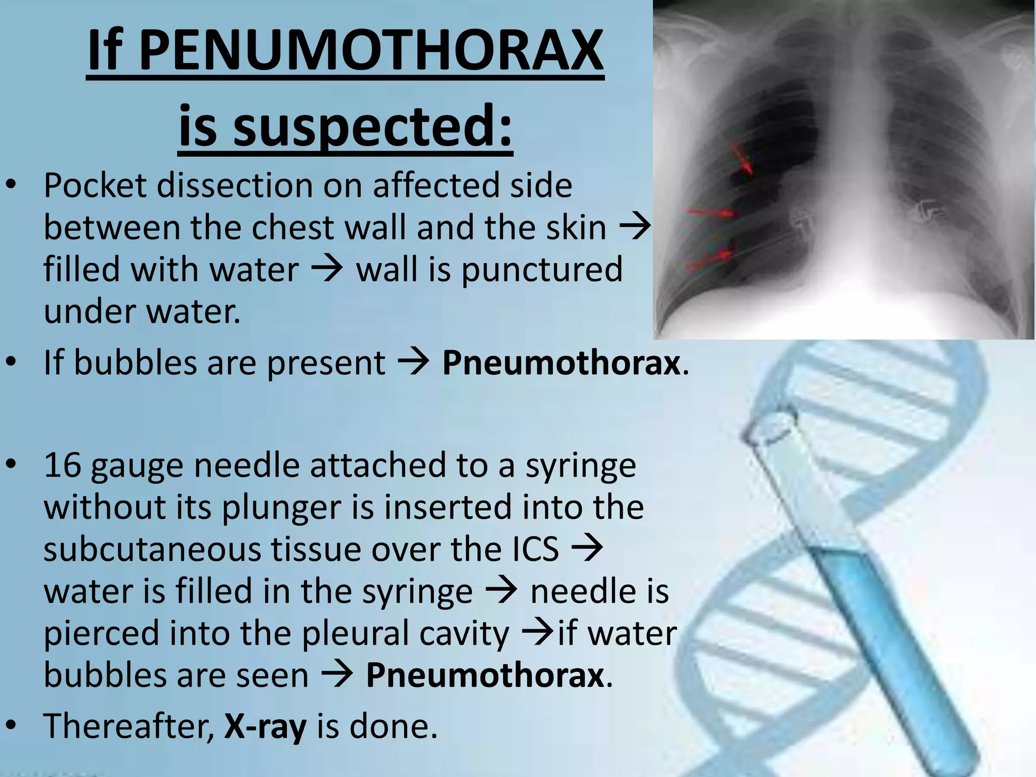 Autopsy internal examination, Forensic Medicine, Post-mortem ...