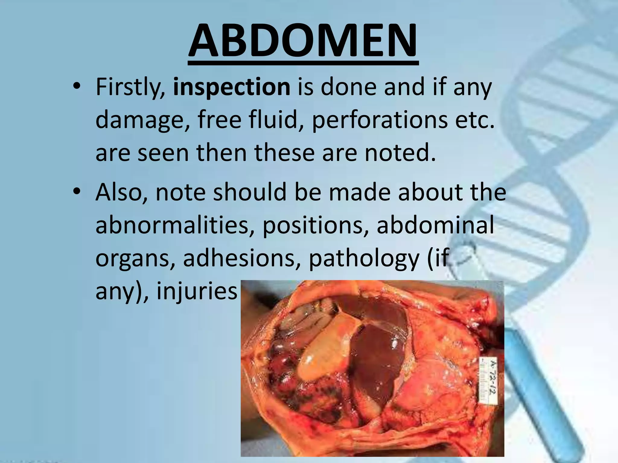 Autopsy internal examination, Forensic Medicine, Post-mortem ...