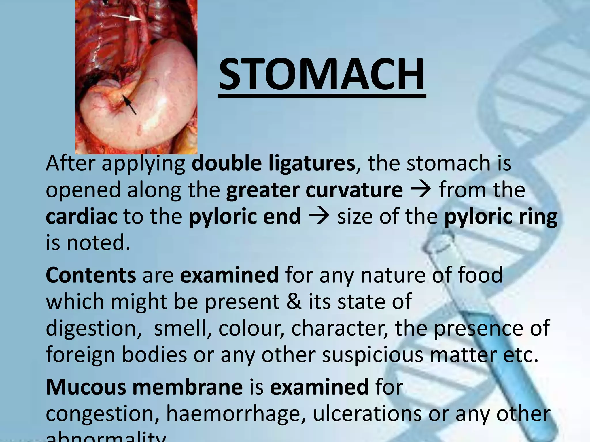 Autopsy internal examination, Forensic Medicine, Post-mortem ...