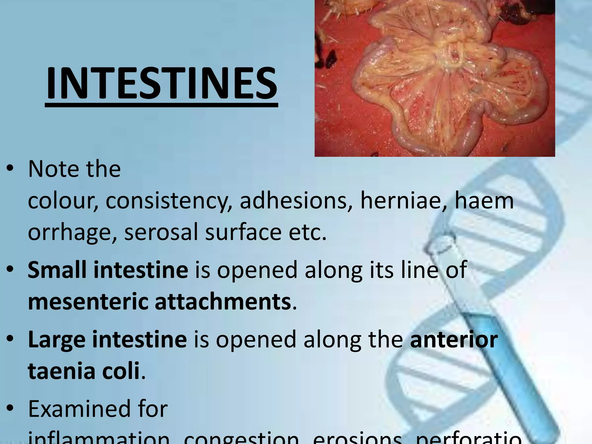 Autopsy internal examination, Forensic Medicine, Post-mortem ...