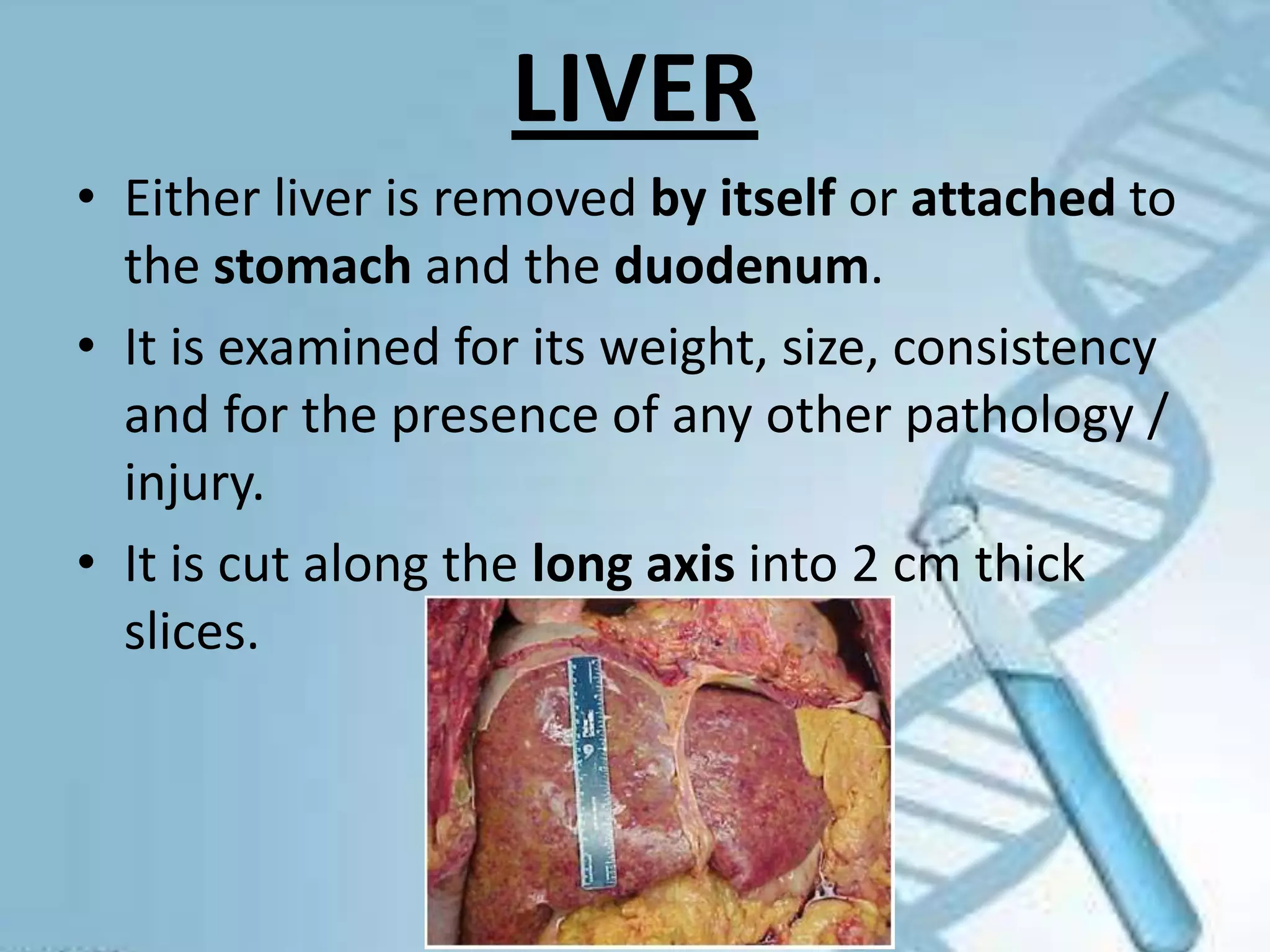 Autopsy internal examination, Forensic Medicine, Post-mortem ...