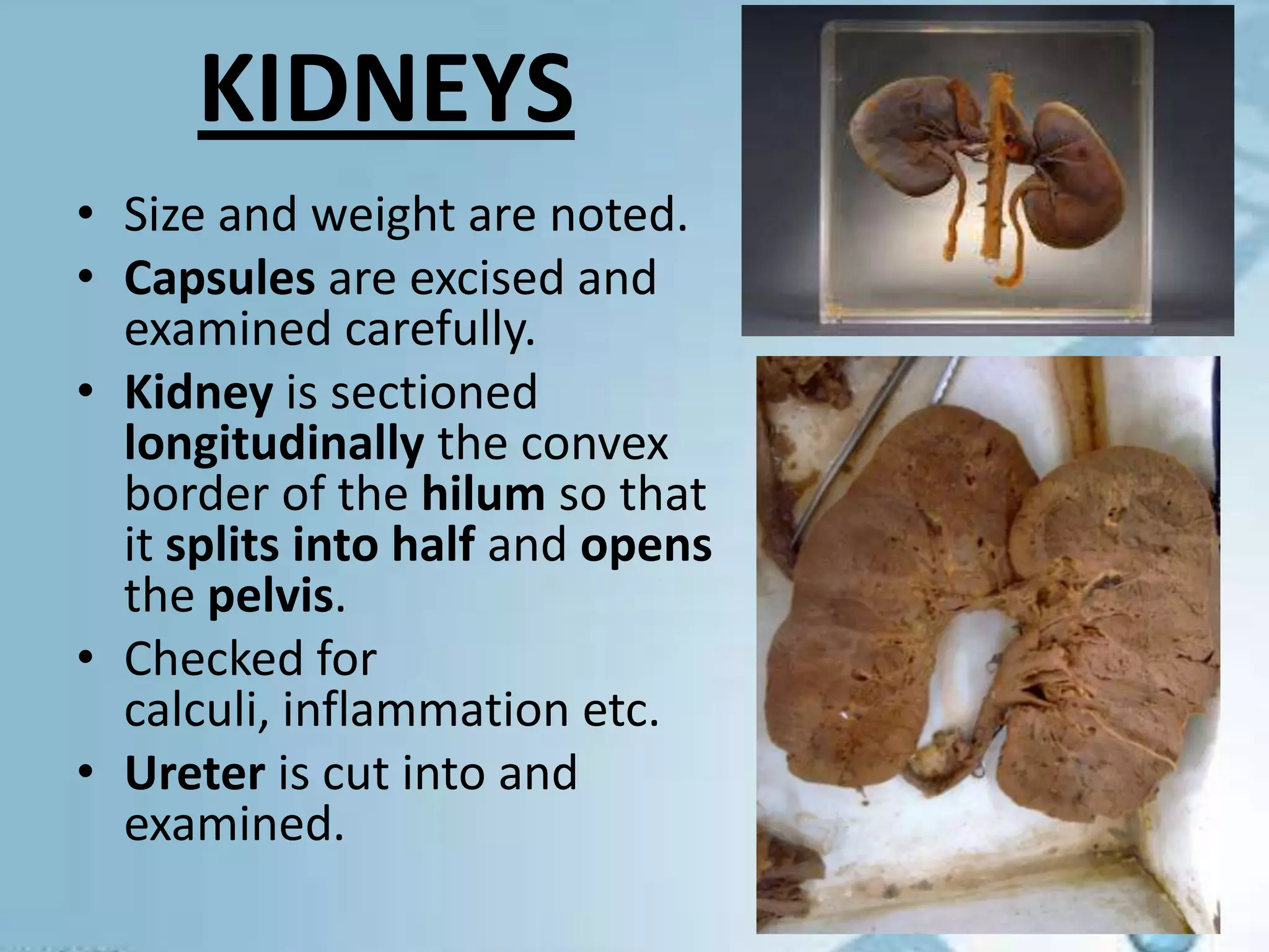 Autopsy internal examination, Forensic Medicine, Post-mortem ...