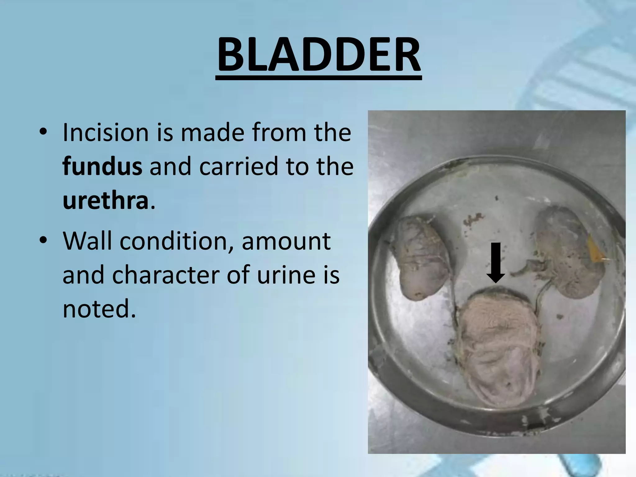 Autopsy internal examination, Forensic Medicine, Post-mortem ...