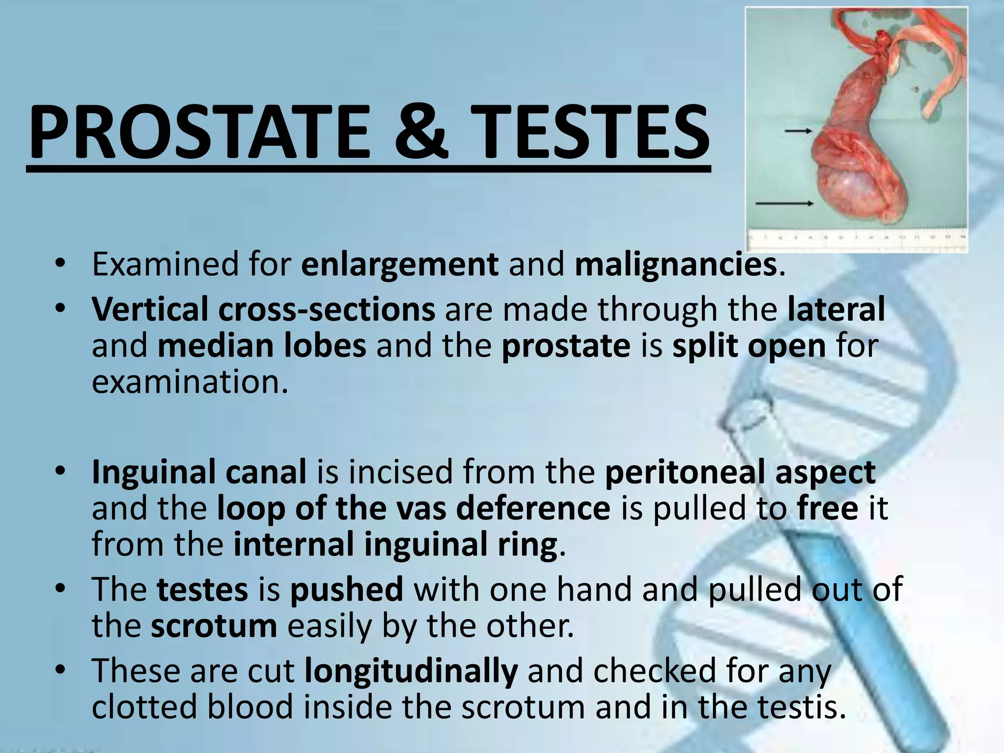 Autopsy internal examination, Forensic Medicine, Post-mortem ...