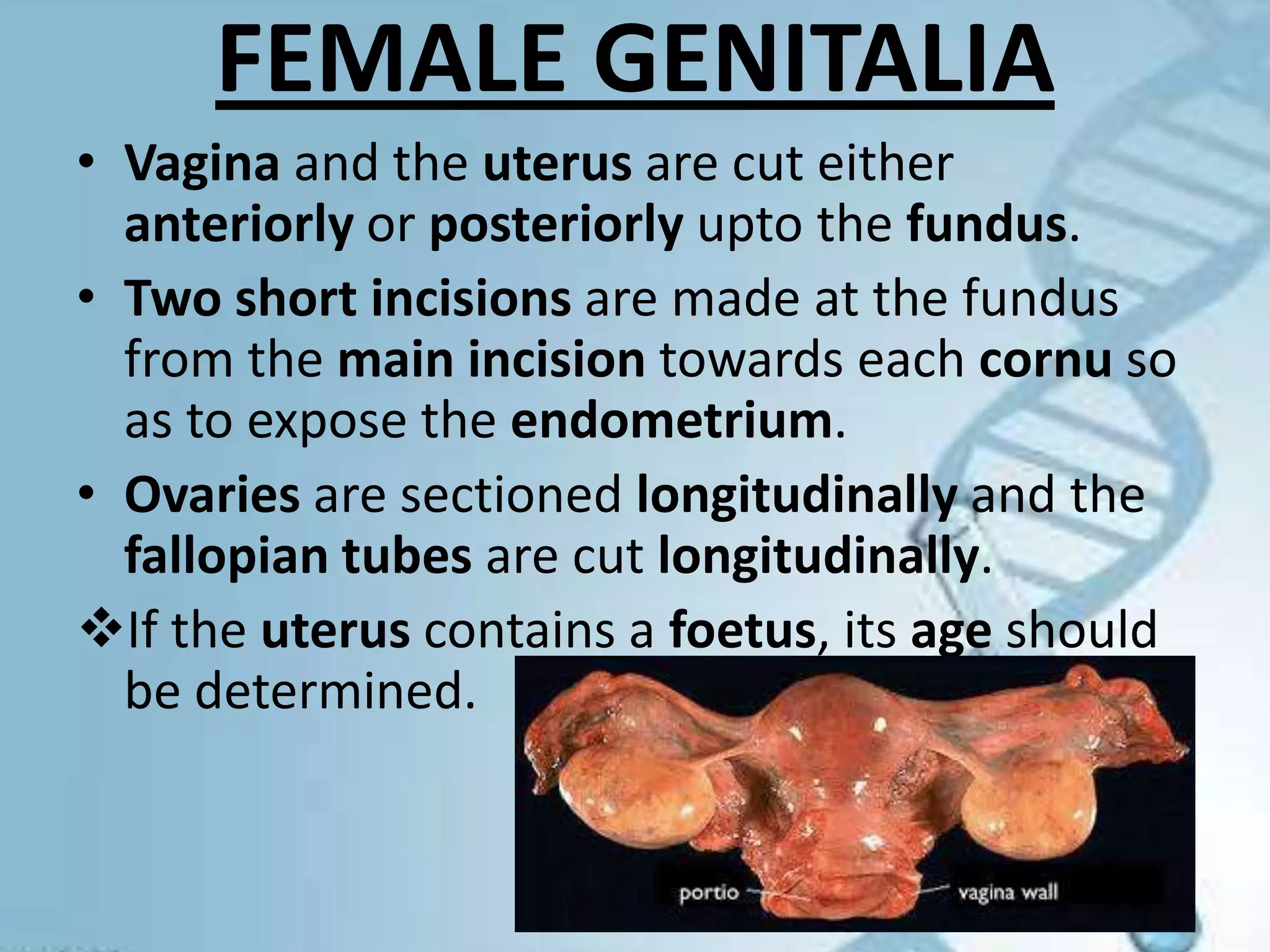 Autopsy internal examination, Forensic Medicine, Post-mortem ...