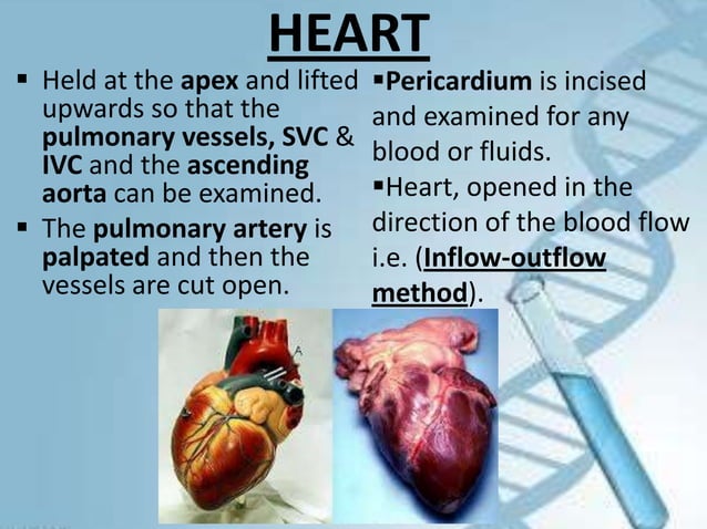 Autopsy internal examination, Forensic Medicine, Post-mortem ...