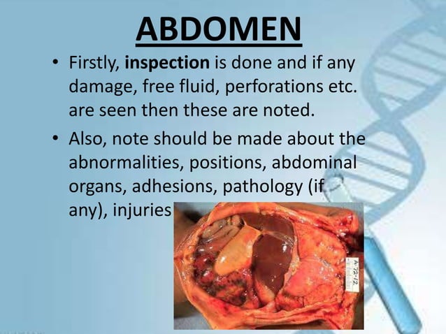 Autopsy internal examination, Forensic Medicine, Post-mortem ...