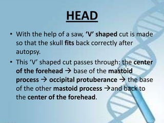 Autopsy internal examination, Forensic Medicine, Post-mortem ...