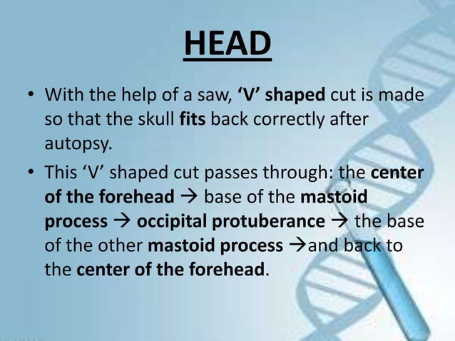 Autopsy internal examination, Forensic Medicine, Post-mortem ...
