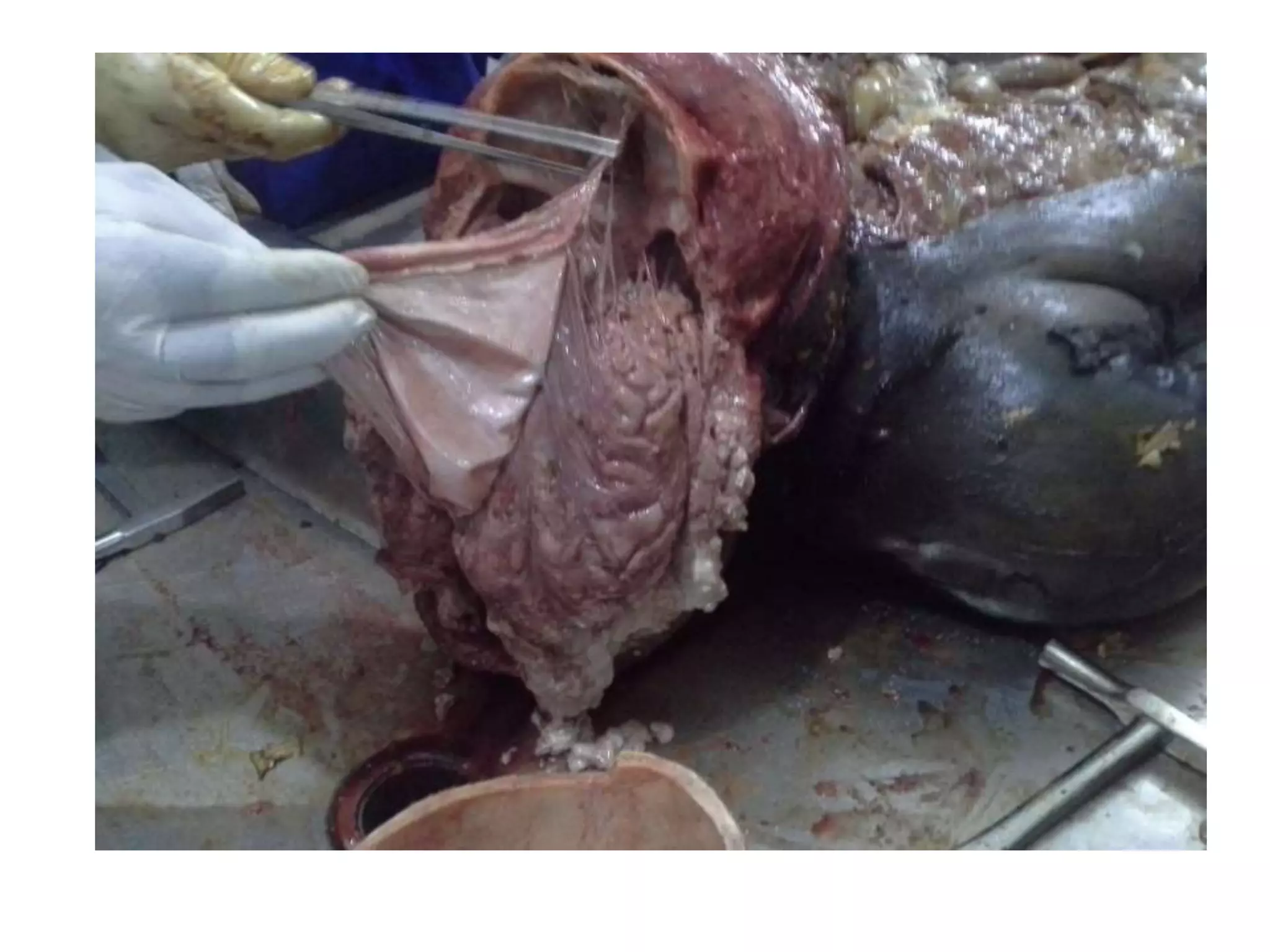 Autopsy Lectures.pptx