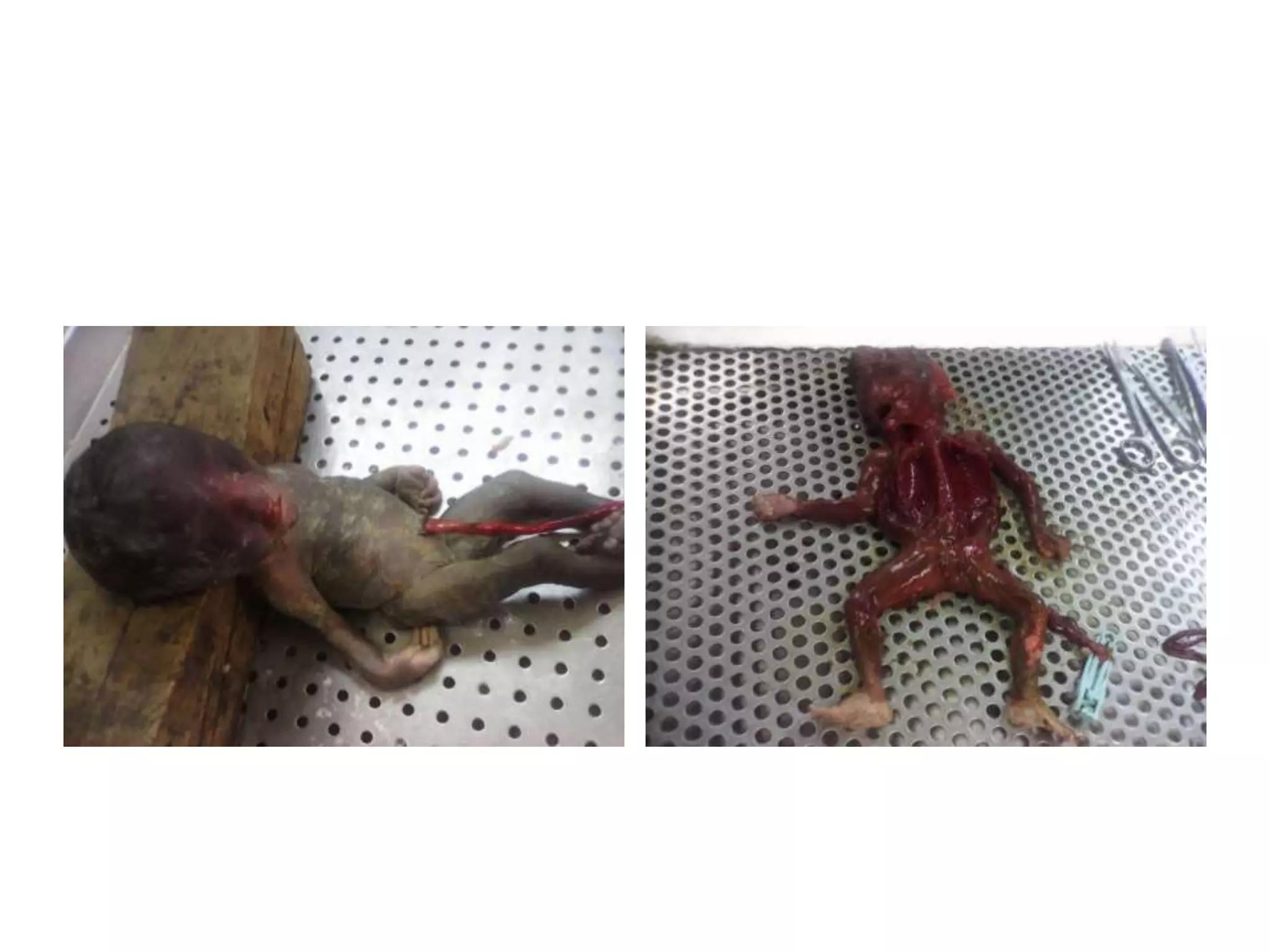 Autopsy Lectures.pptx