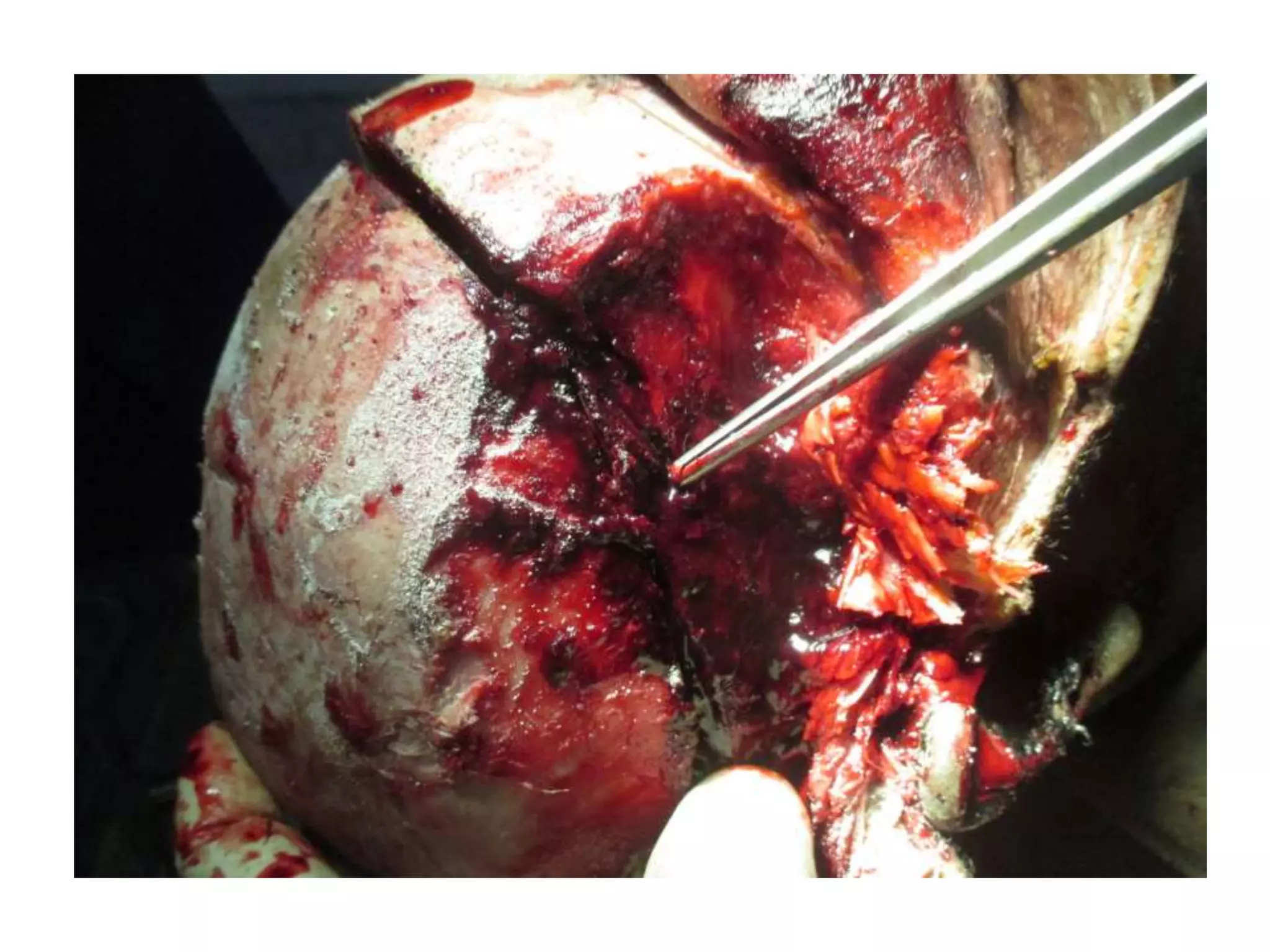 Autopsy Lectures.pptx