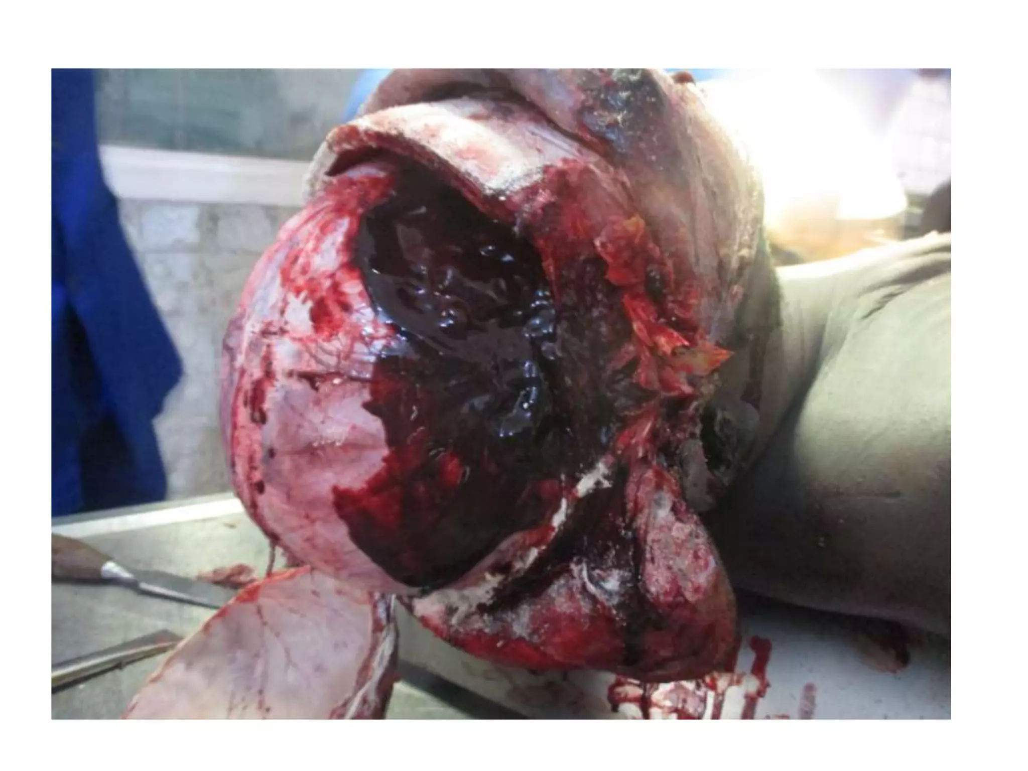 Autopsy Lectures.pptx