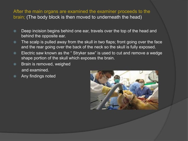 Autopsy Presentation.pptx