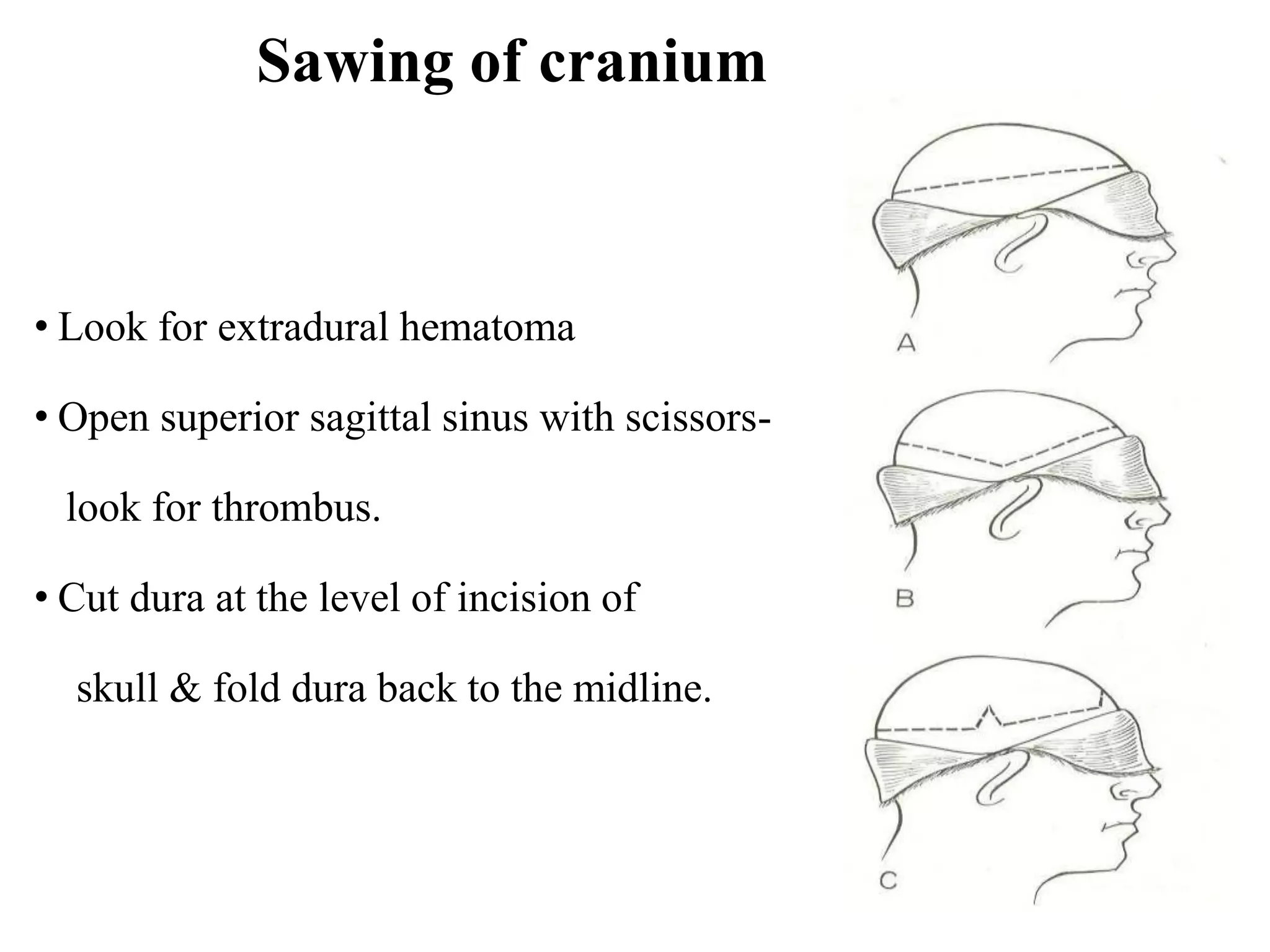 Autopsy techniques.ppt