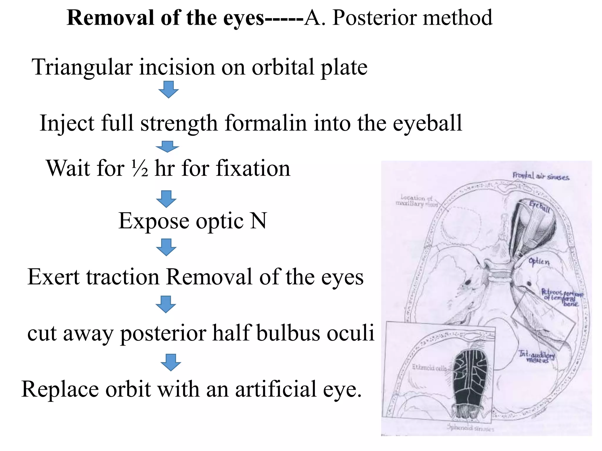Autopsy techniques.ppt