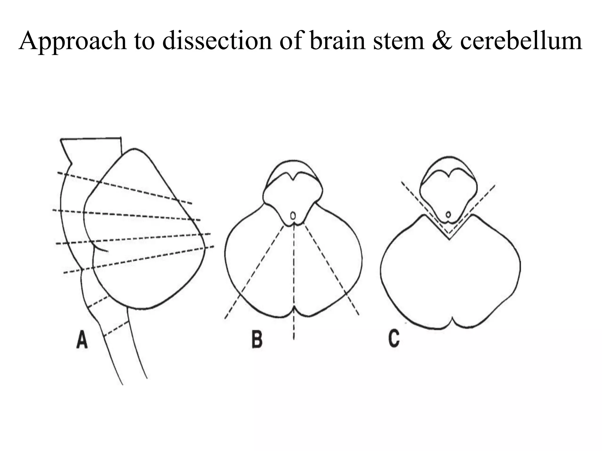 Autopsy techniques.ppt