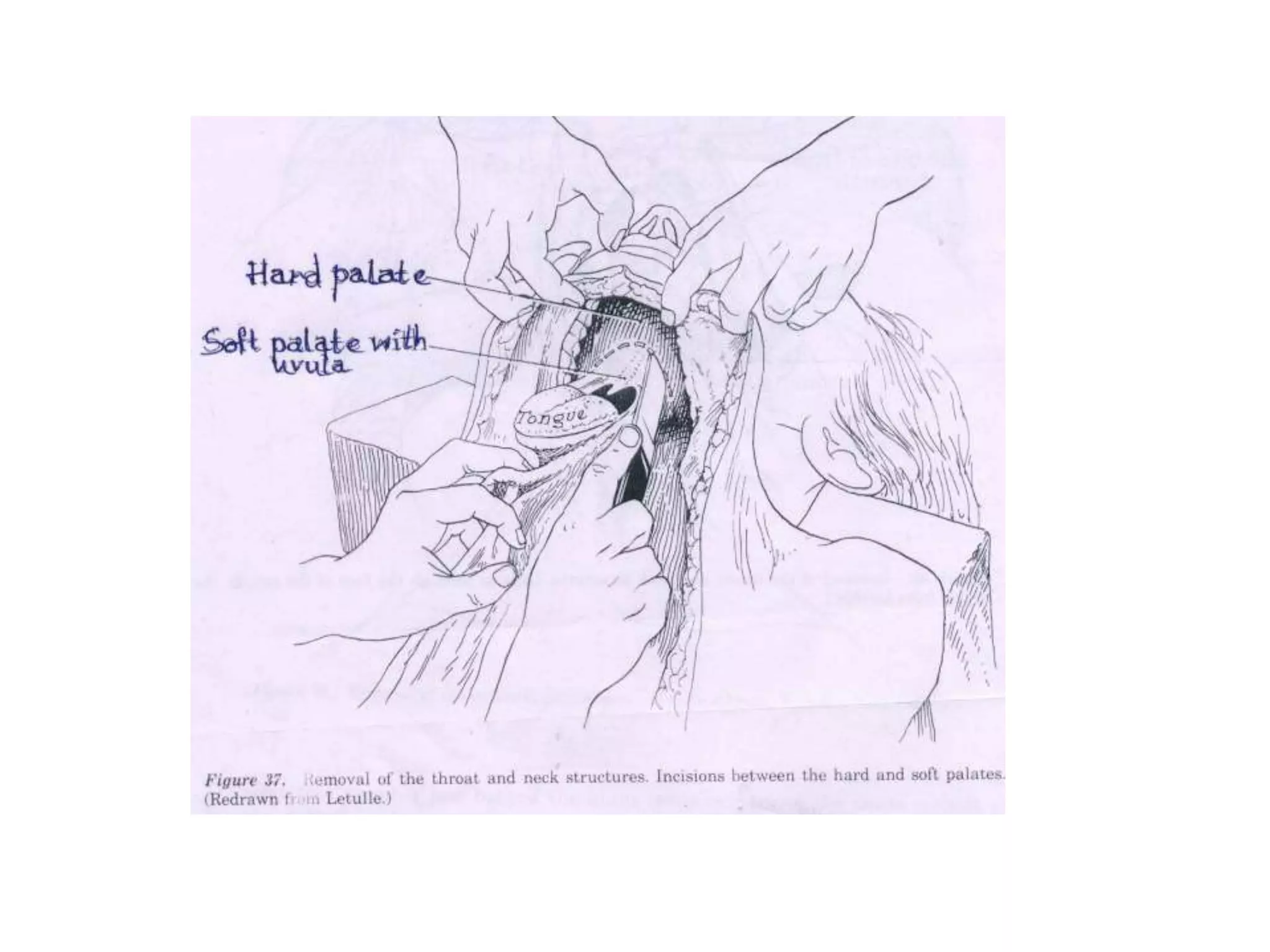 Autopsy techniques.ppt