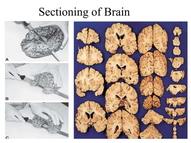 Autopsy techniques.ppt