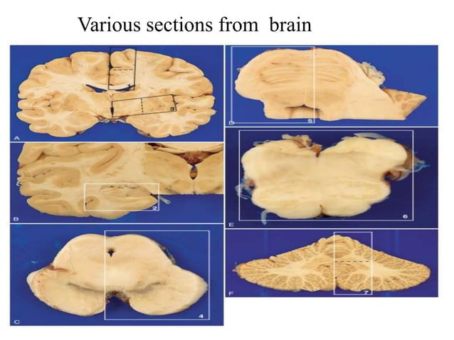 Autopsy techniques.ppt
