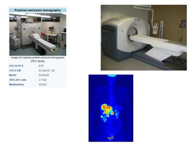 Autoradiography | PPTX