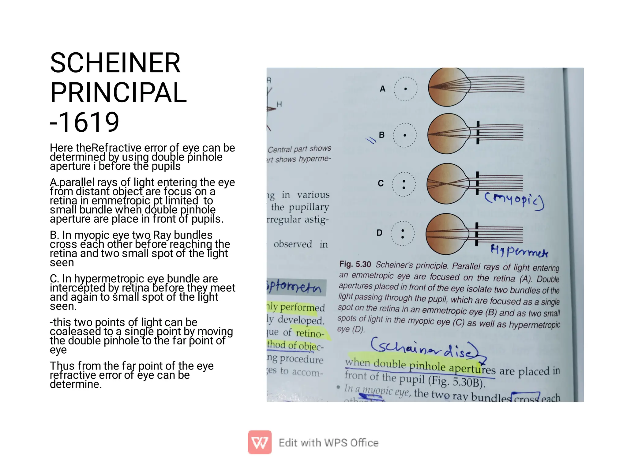 AUTO REFRACTOME- basic review formulaes and recent advances | PPT