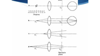 AUTOREFRACTOMETER.pdf