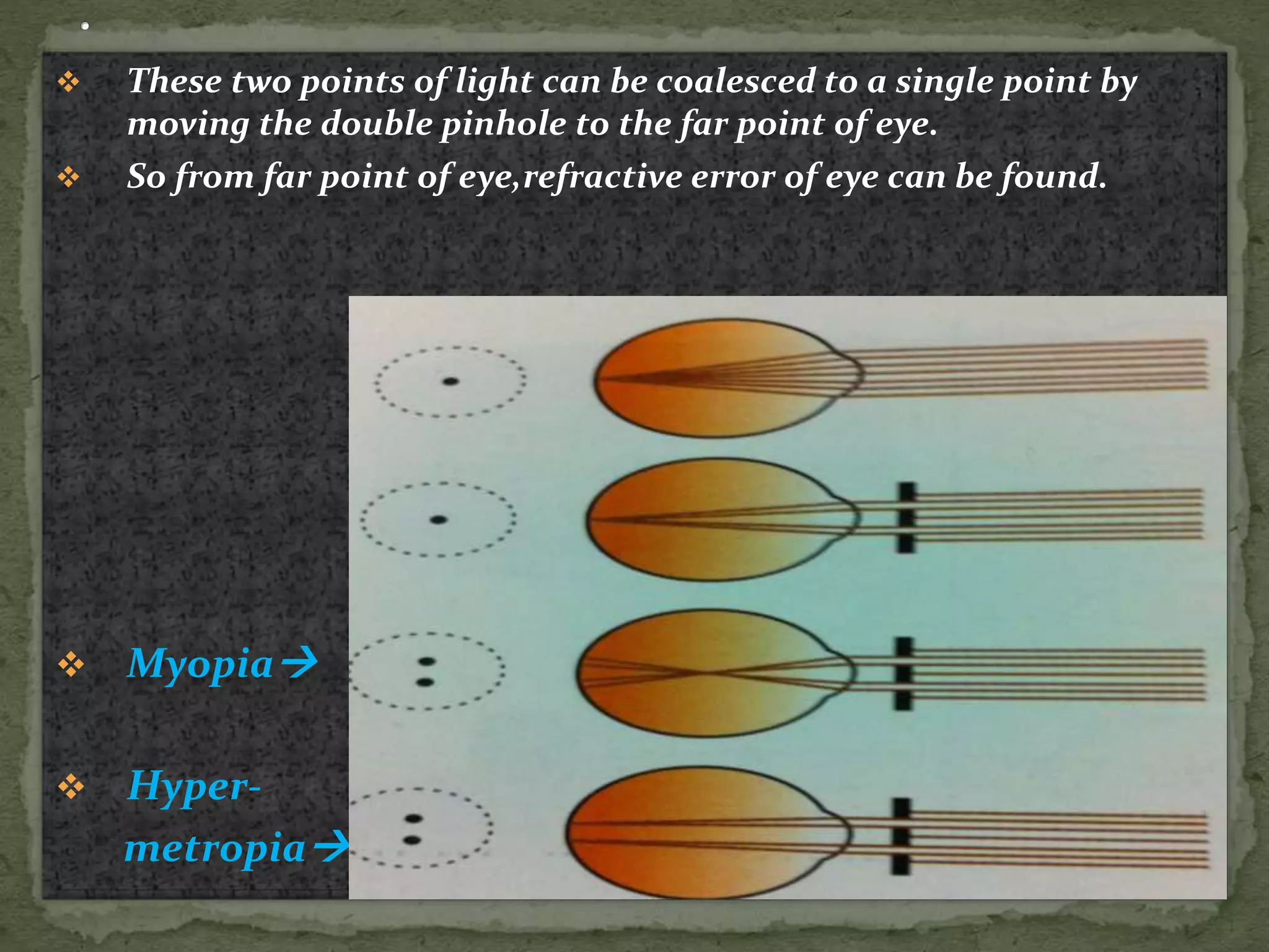 Autorefractometry: principle and procedure. | PPTX