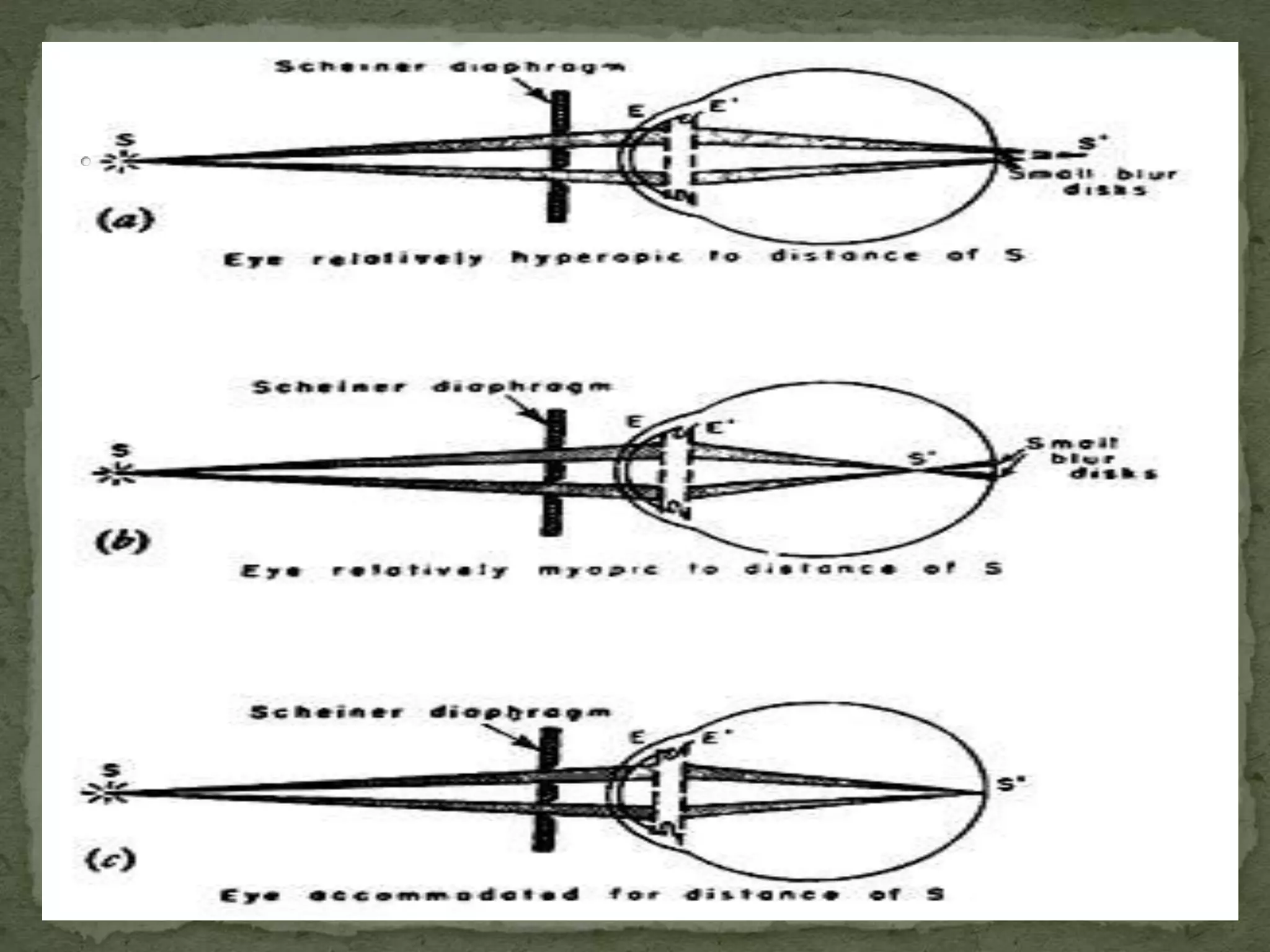 Autorefractometry: principle and procedure. | PPTX