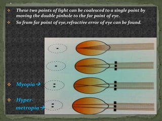 Autorefractometry: principle and procedure. | PPTX