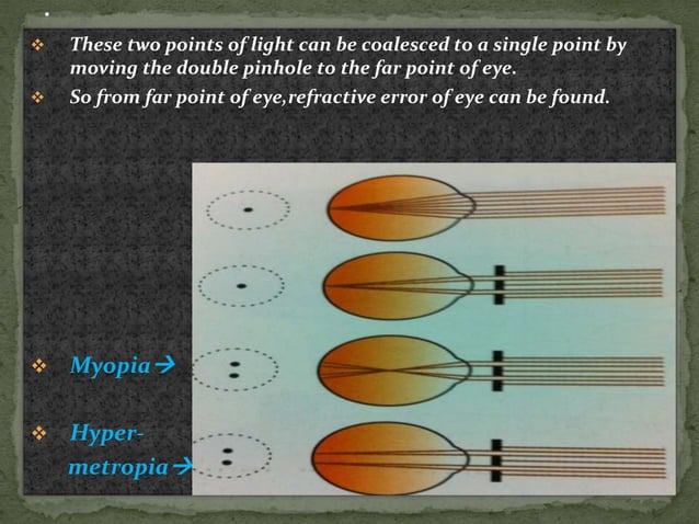 Autorefractometry: principle and procedure. | PPTX