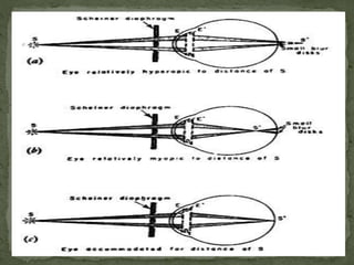 Autorefractometry: principle and procedure. | PPTX