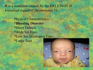 Autosomal Aberrations | PPTX