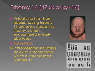 Autosomal and sexual aneuploidy2 | PPTX