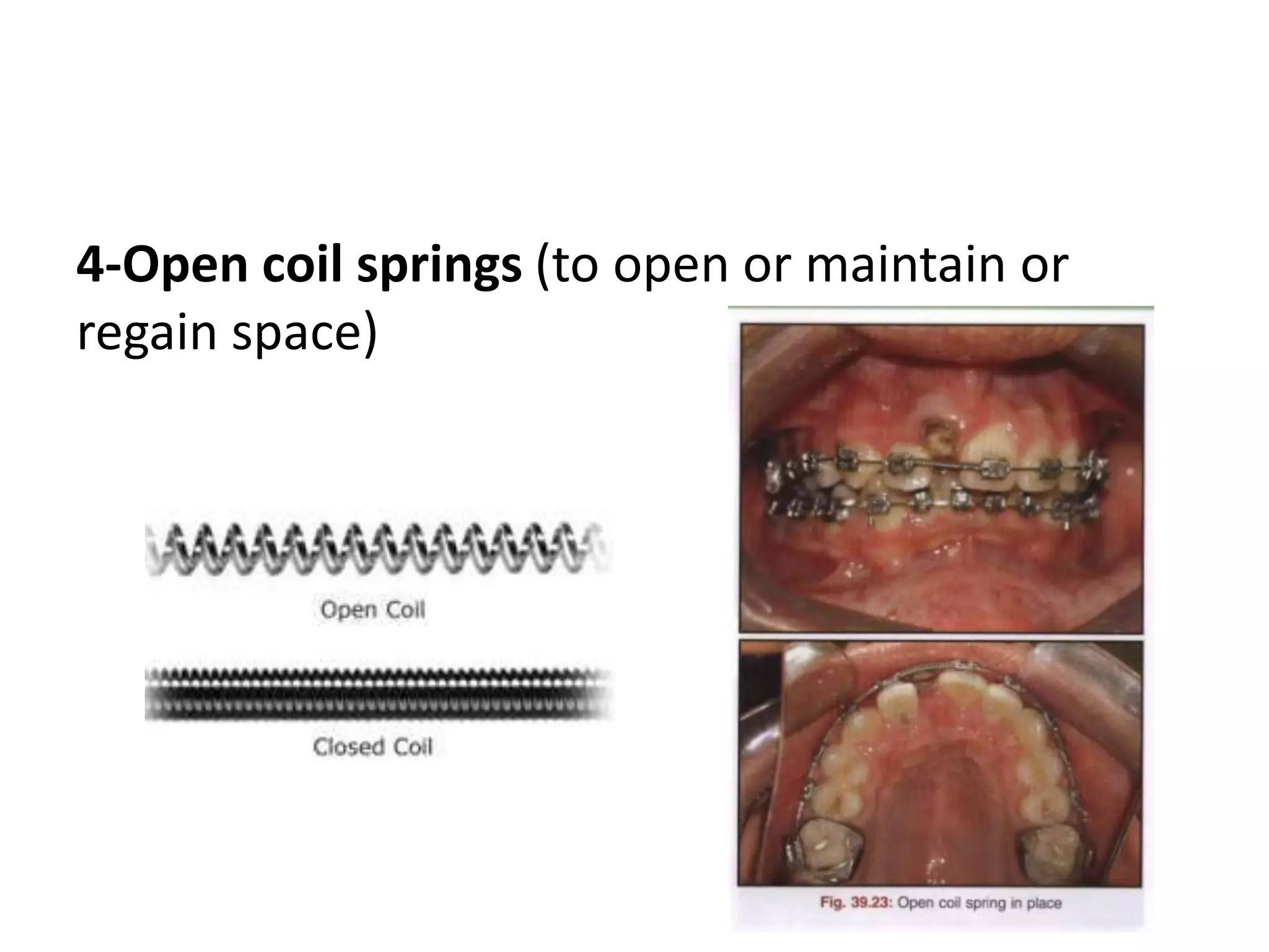 Auxiliary attachment | PPTX