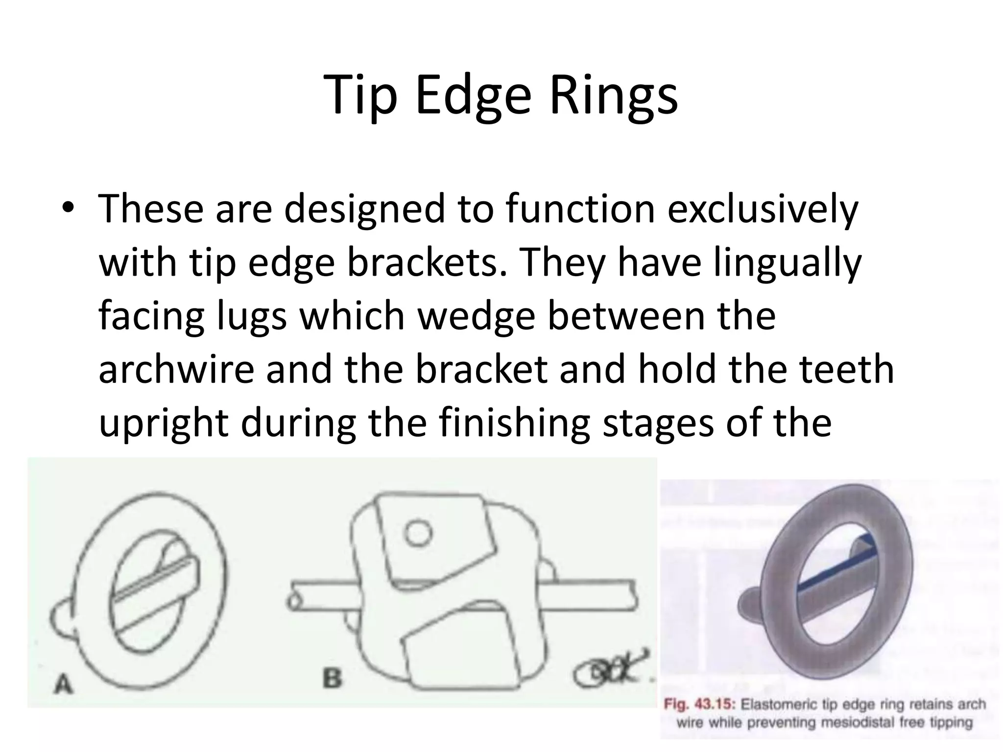 Auxiliary attachment | PPTX